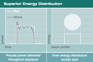 Integre Pro | Photocoagulation | Products | エレックス株式会社